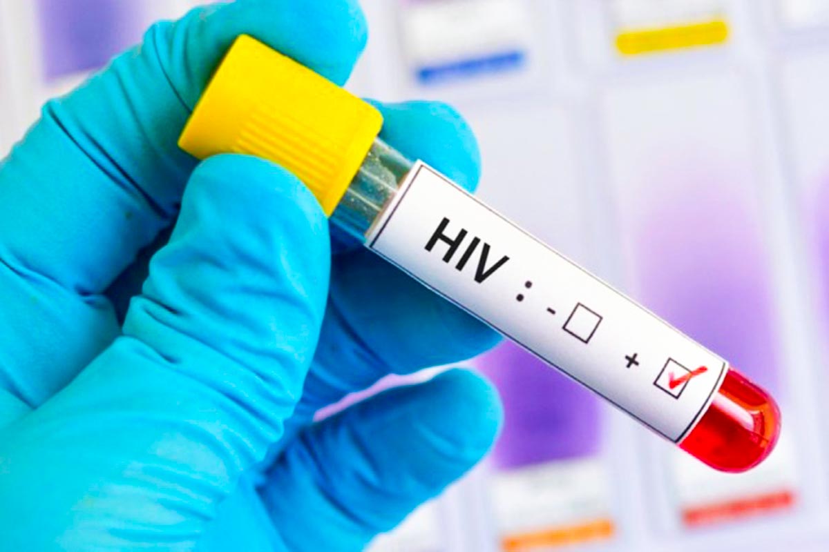 Modelos diferenciados de prestação de serviços de tratamento do HIV são ...